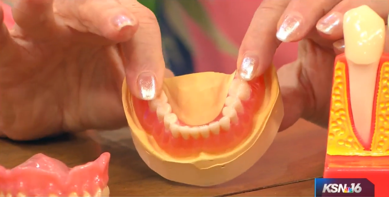 Options for replacing missing teeth